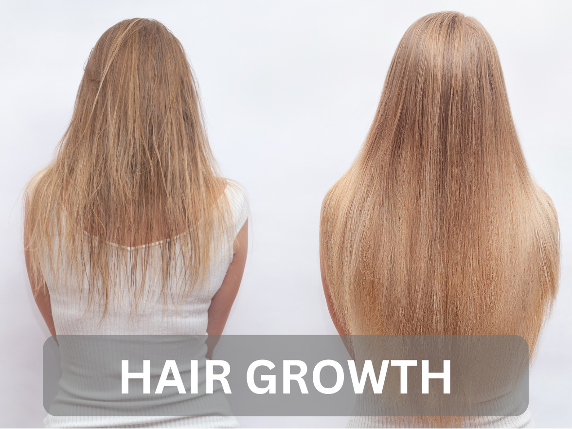 hair growth – ChemistDirect.pk